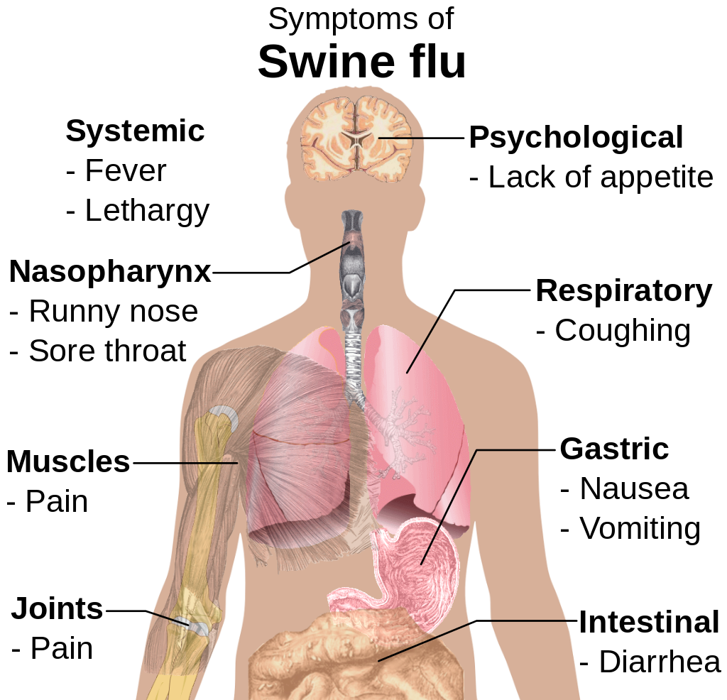Flu (Influenza) — Symptoms and Treatment | Online Medical Library Flu (Influenza) — Symptoms and Treatment | Online Medical Library